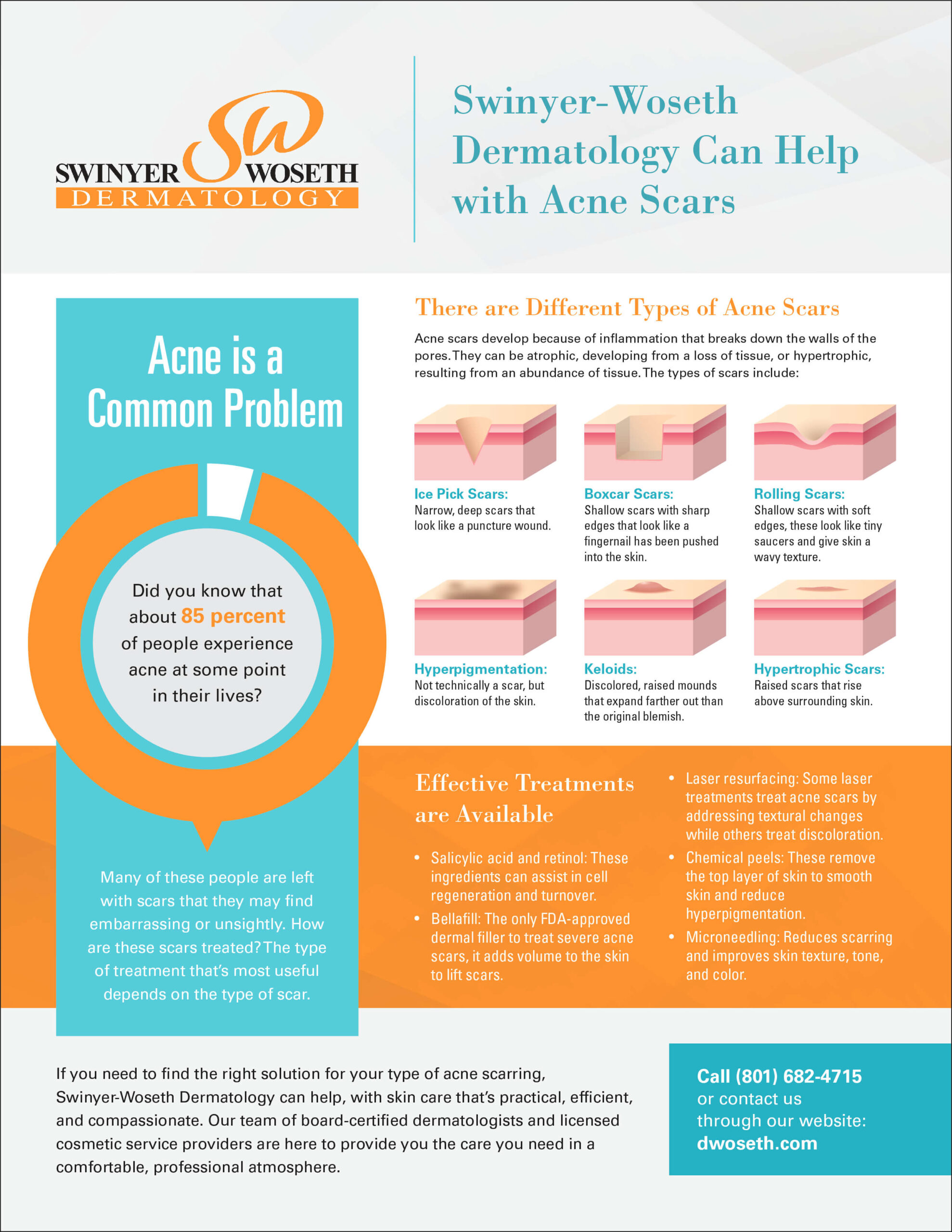 Types of Acne Scars and How to Treat Them | Swinyer Woseth Dermatology